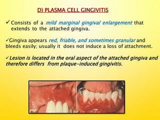 Plasma Cell Gingivitis
