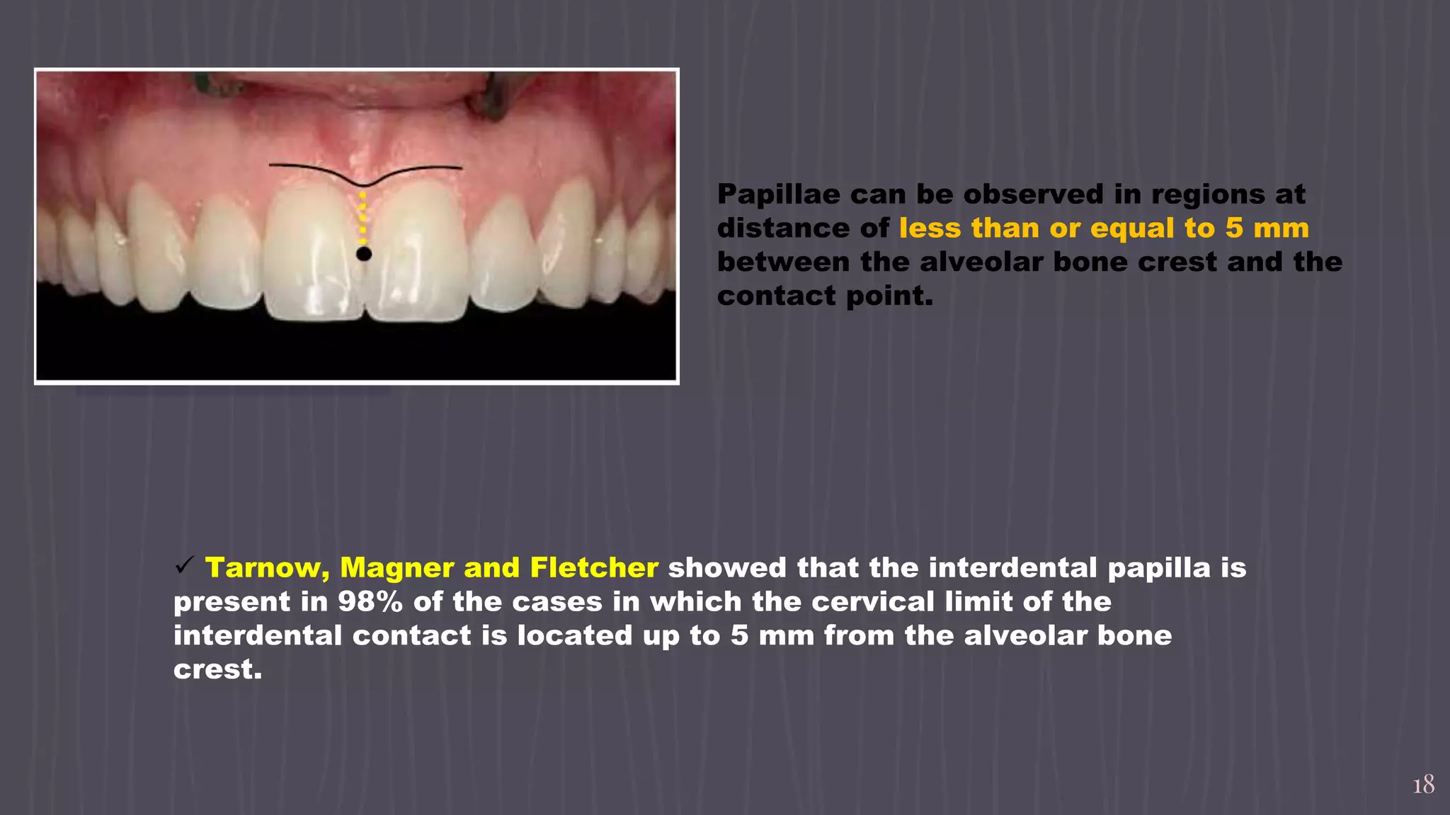 Gingival esthetics | PPTX