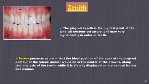 Gingival esthetics