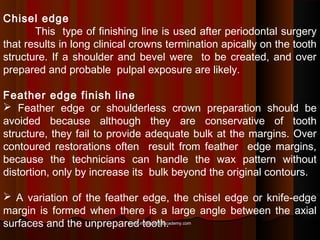 Gingival finish lines /certified fixed orthodontic courses by Indian ...