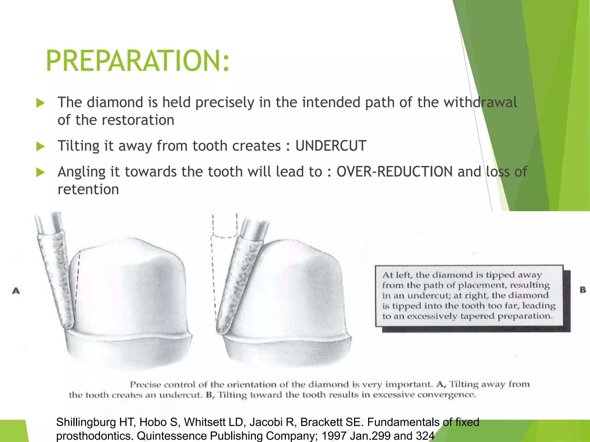 Gingival finish lines in fixed prosthodontics | PPT