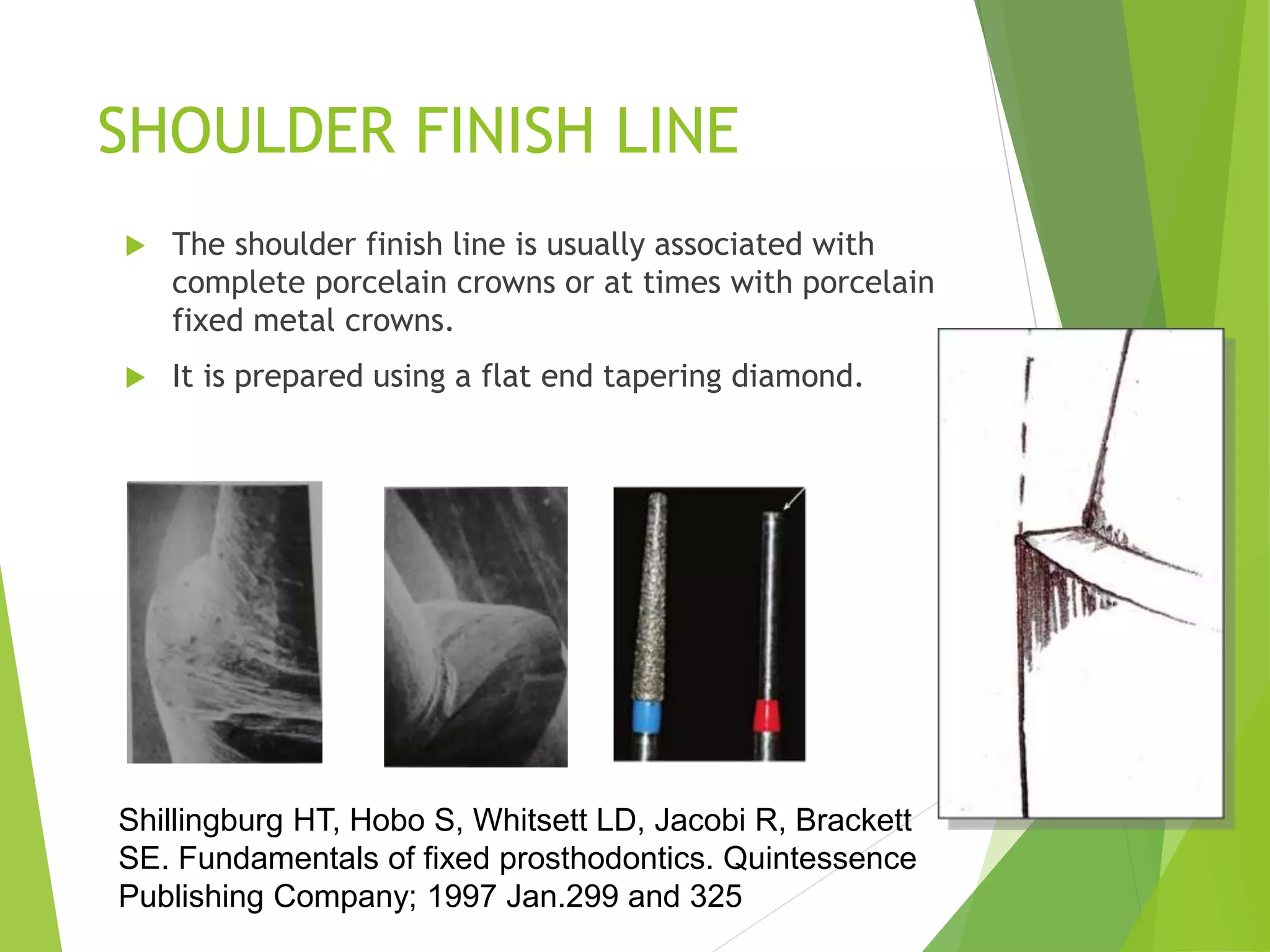 Gingival finish lines in fixed prosthodontics | PPT