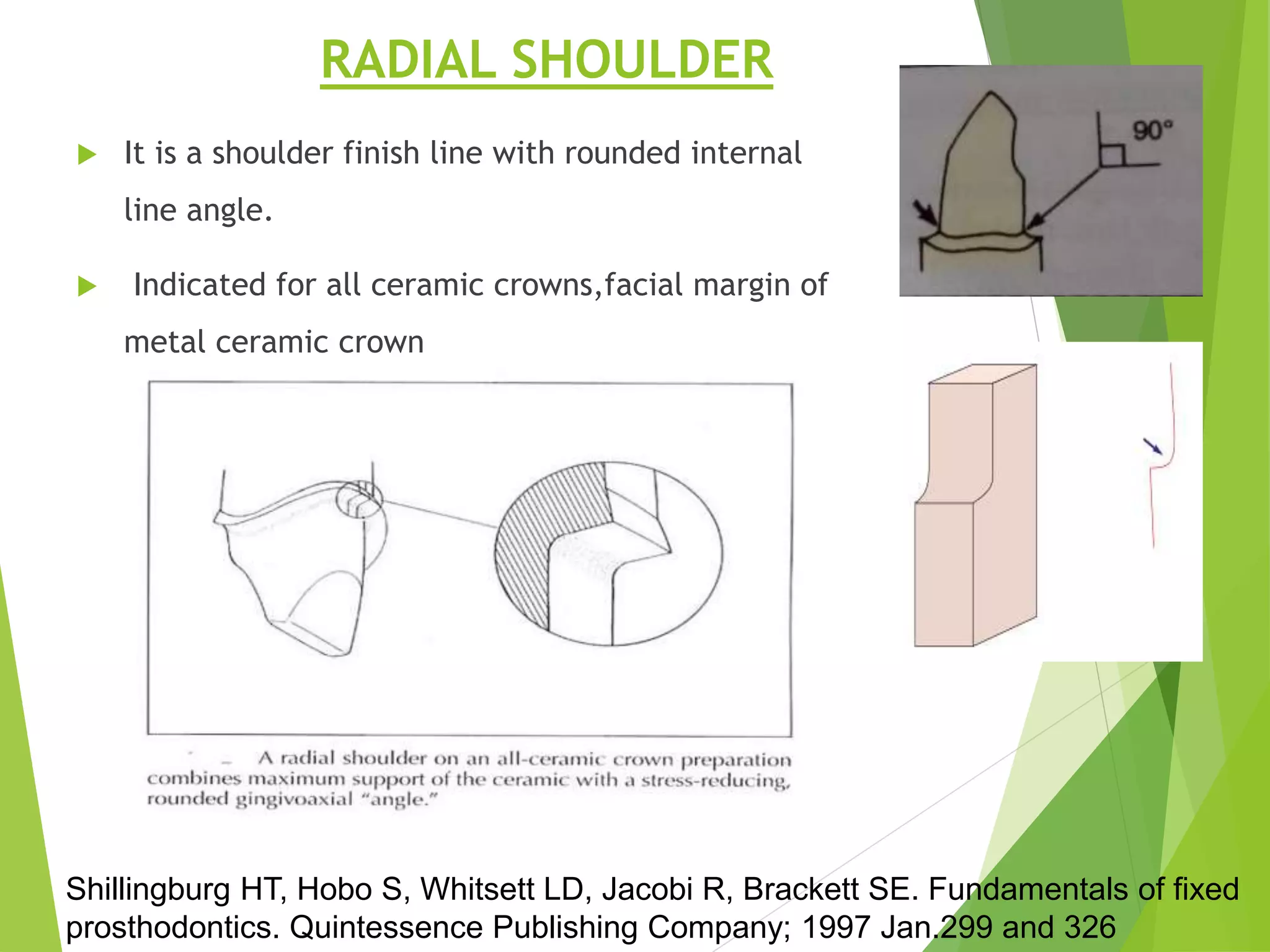 Gingival finish lines in fixed prosthodontics | PPT