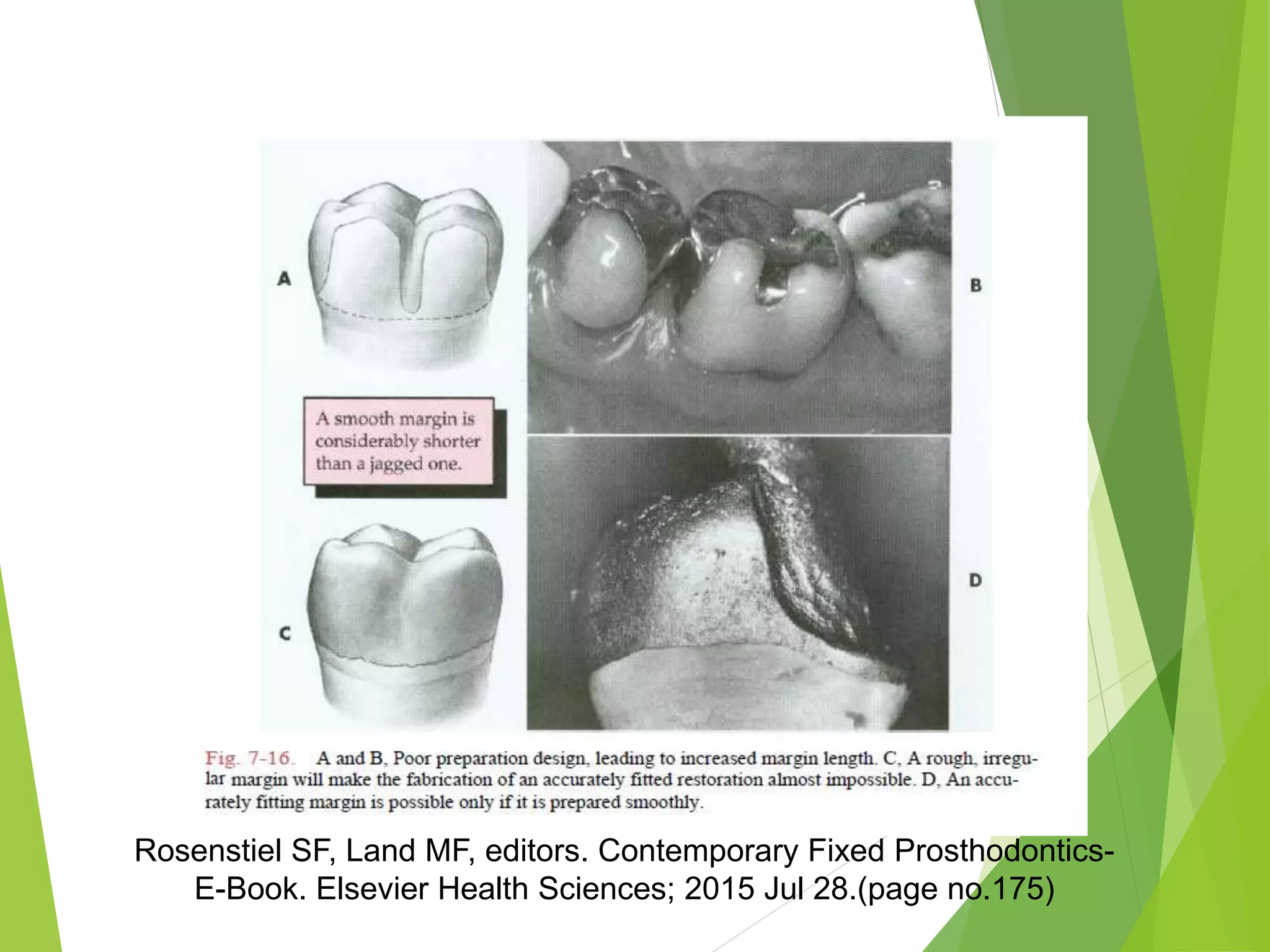 Gingival finish lines in fixed prosthodontics | PPT
