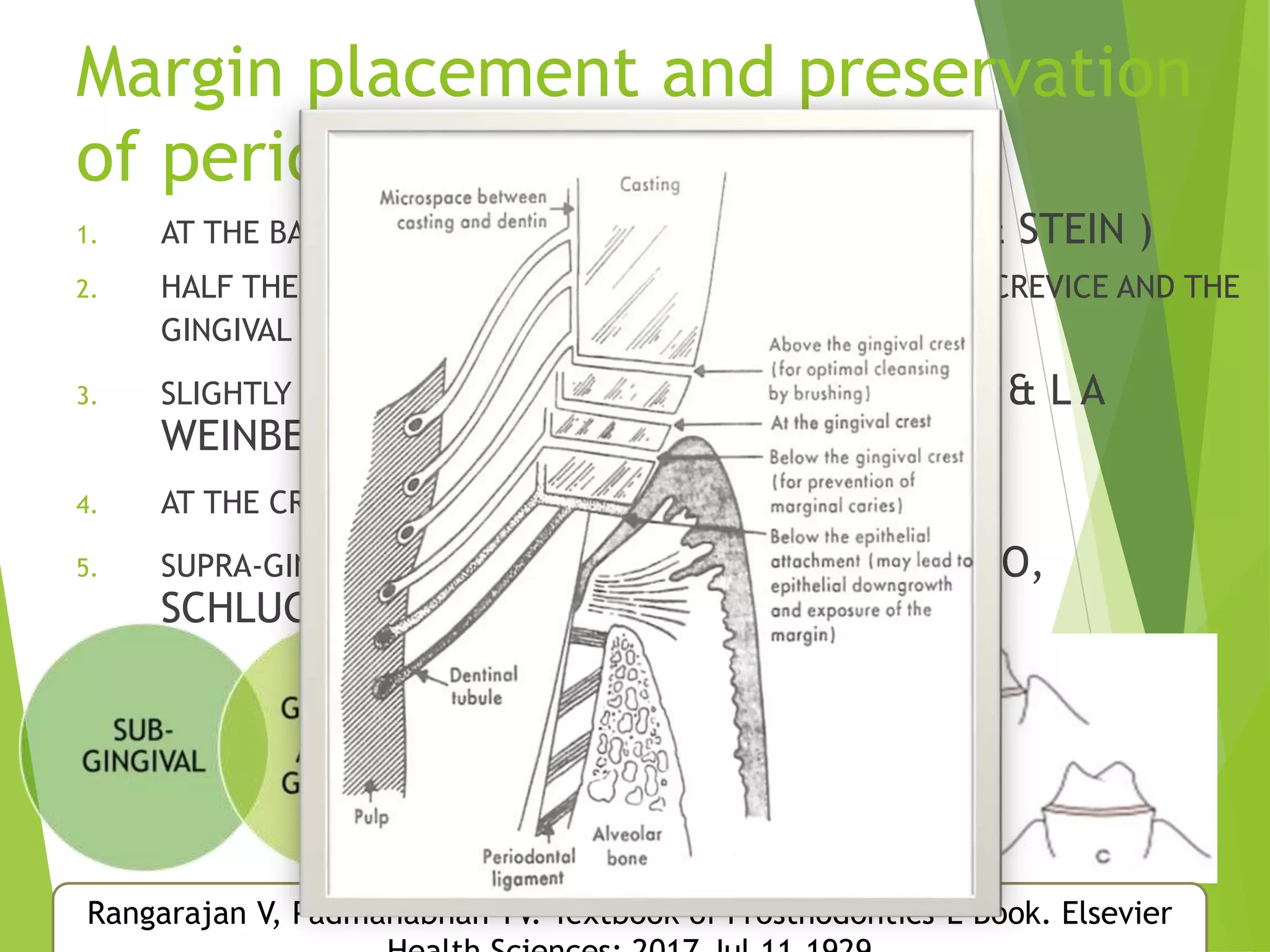 Gingival finish lines in fixed prosthodontics | PPT
