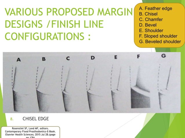Gingival finish lines in fixed prosthodontics | PPT | Dental Health ...