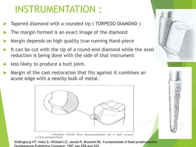 Gingival finish lines in fixed prosthodontics | PPT | Dental Health ...
