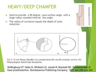 Gingival finish lines in fixed prosthodontics | PPT