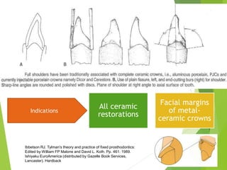 Gingival finish lines in fixed prosthodontics | PPT