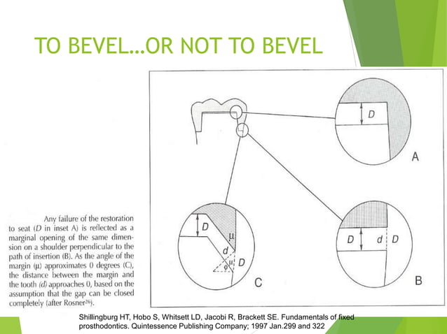 Gingival finish lines in fixed prosthodontics | PPT | Dental Health ...