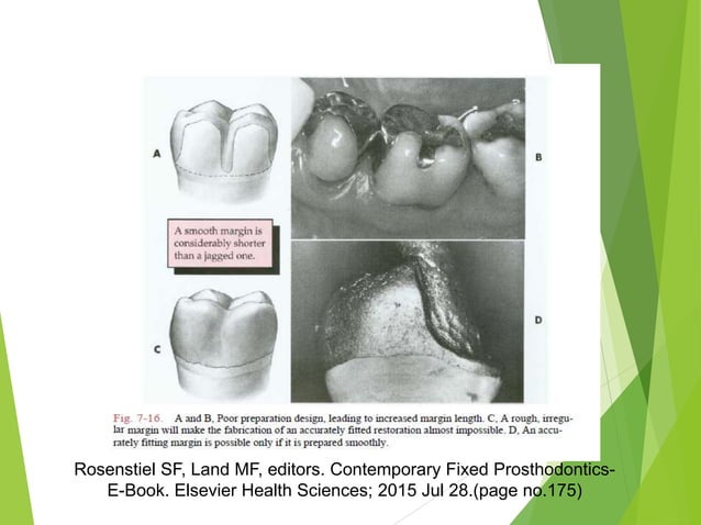 Gingival finish lines in fixed prosthodontics | PPT | Dental Health ...