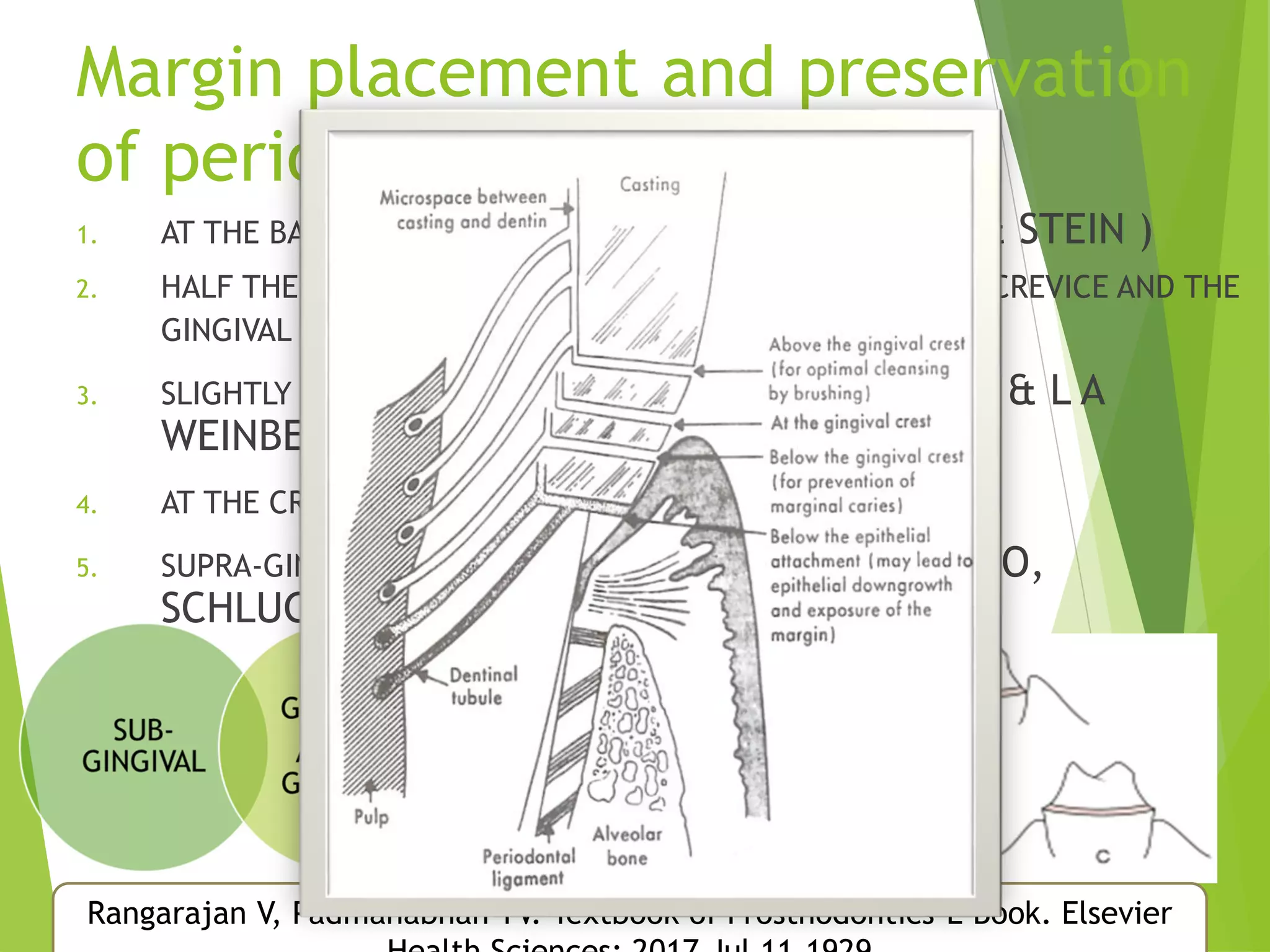 Gingival finish lines in fixed partial denture(FPD) with references | PDF