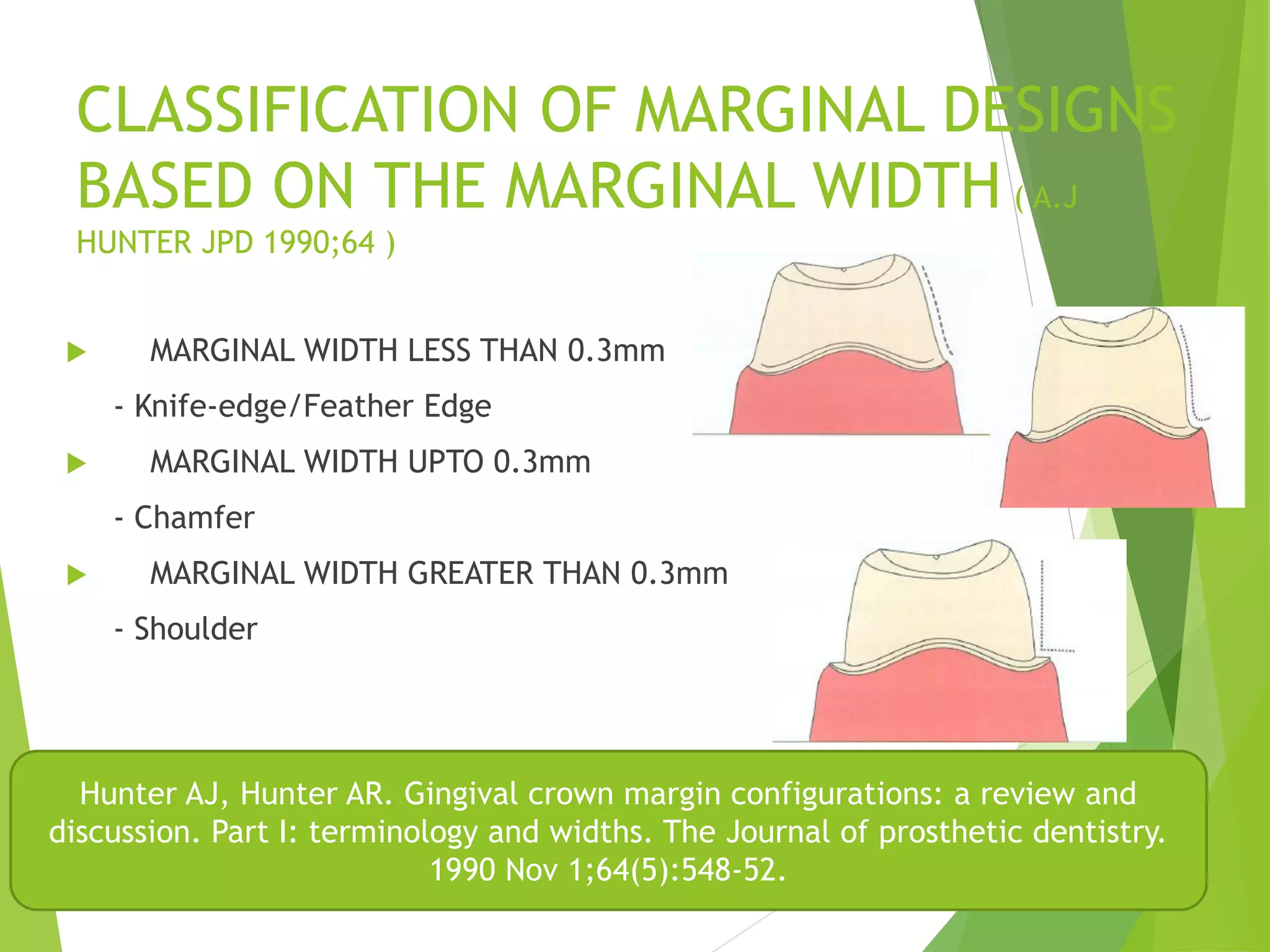Gingival finish lines in fixed partial denture(FPD) with references | PDF