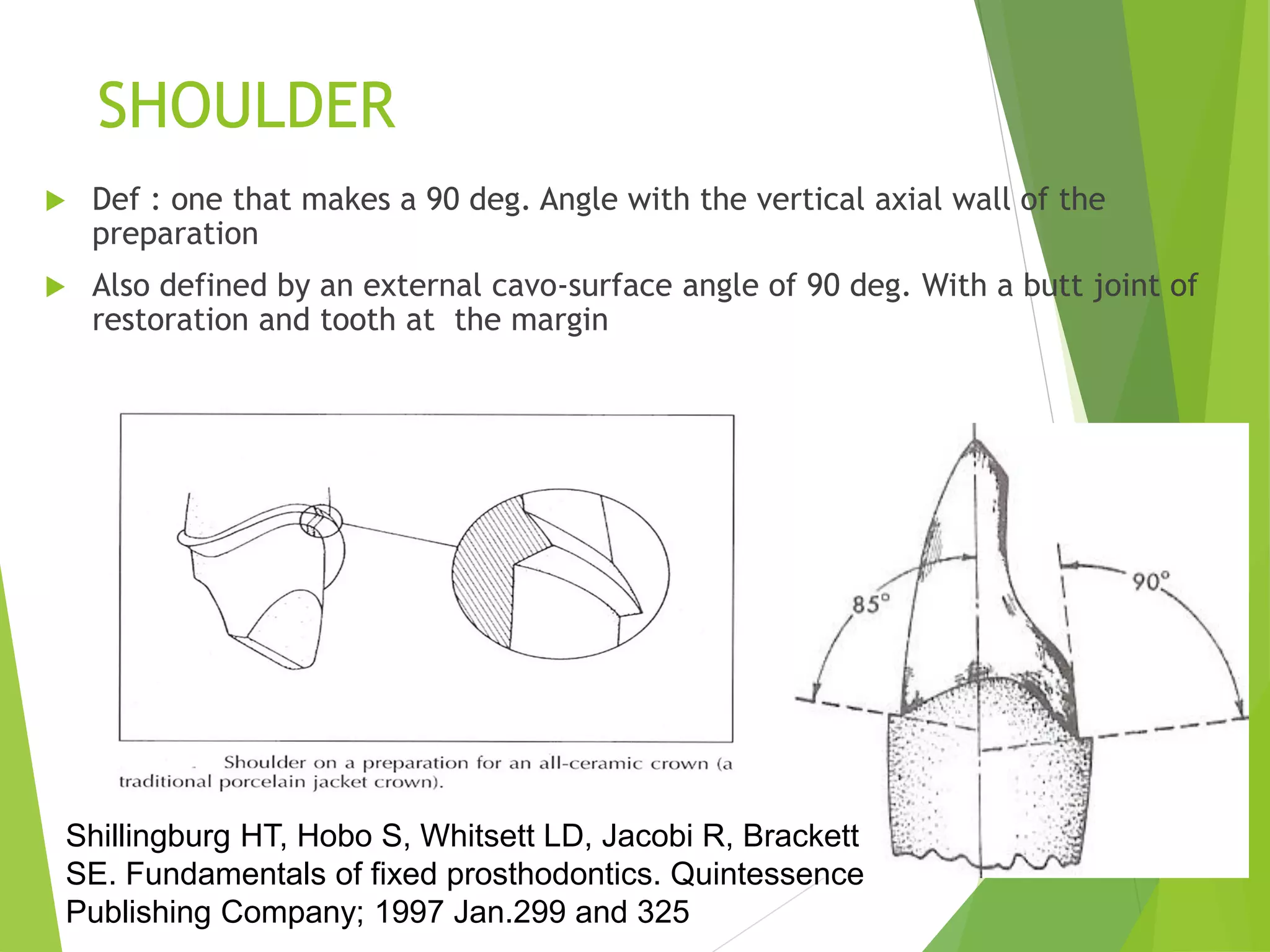 Gingival finish lines in fixed partial denture(FPD) with references | PDF