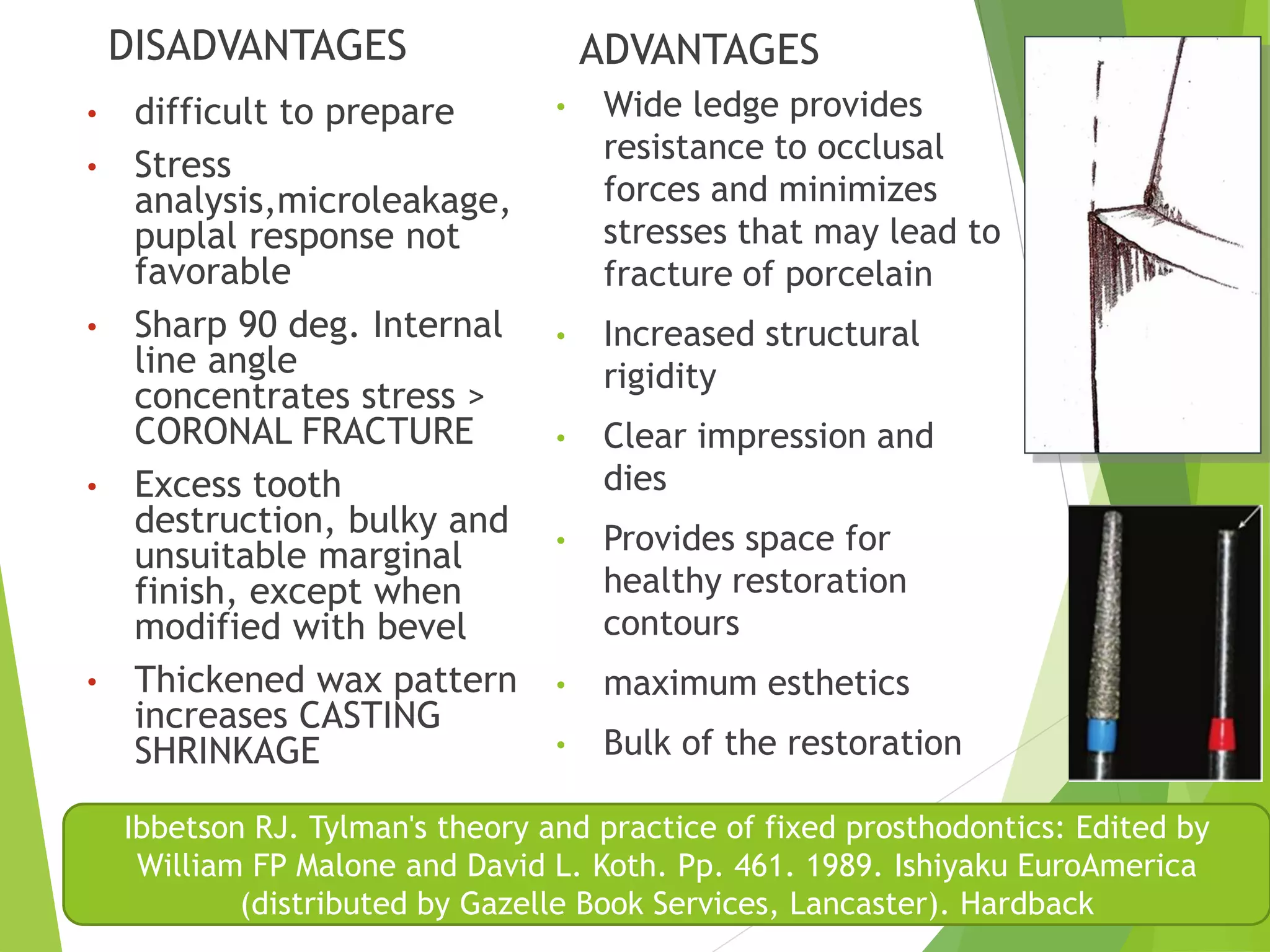 Gingival finish lines in fixed partial denture(FPD) with references | PDF