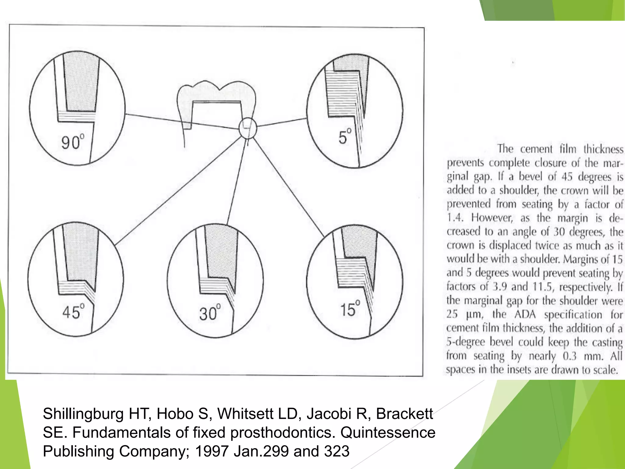 Gingival finish lines in fixed partial denture(FPD) with references | PDF