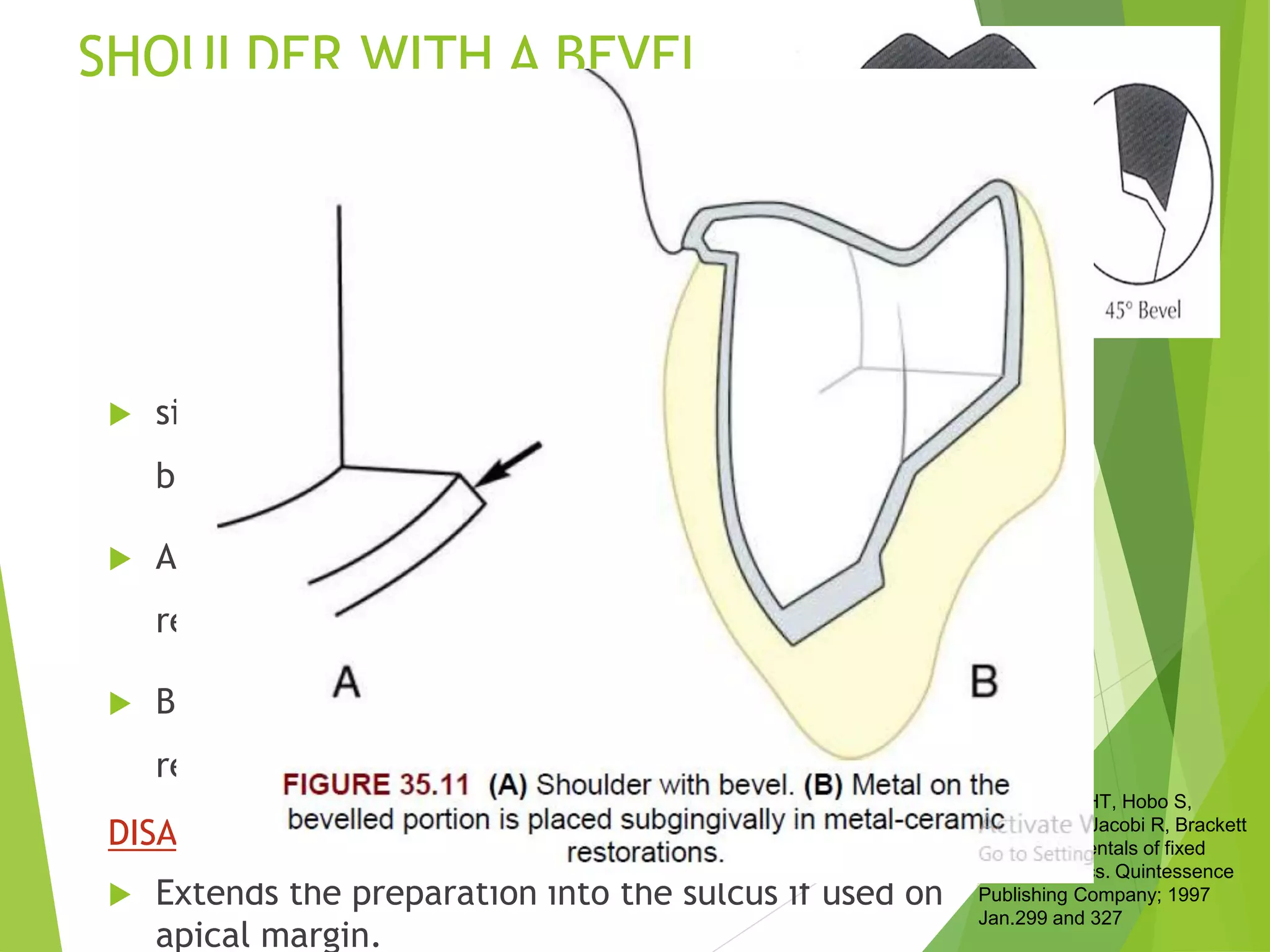 Gingival finish lines in fixed partial denture(FPD) with references | PDF