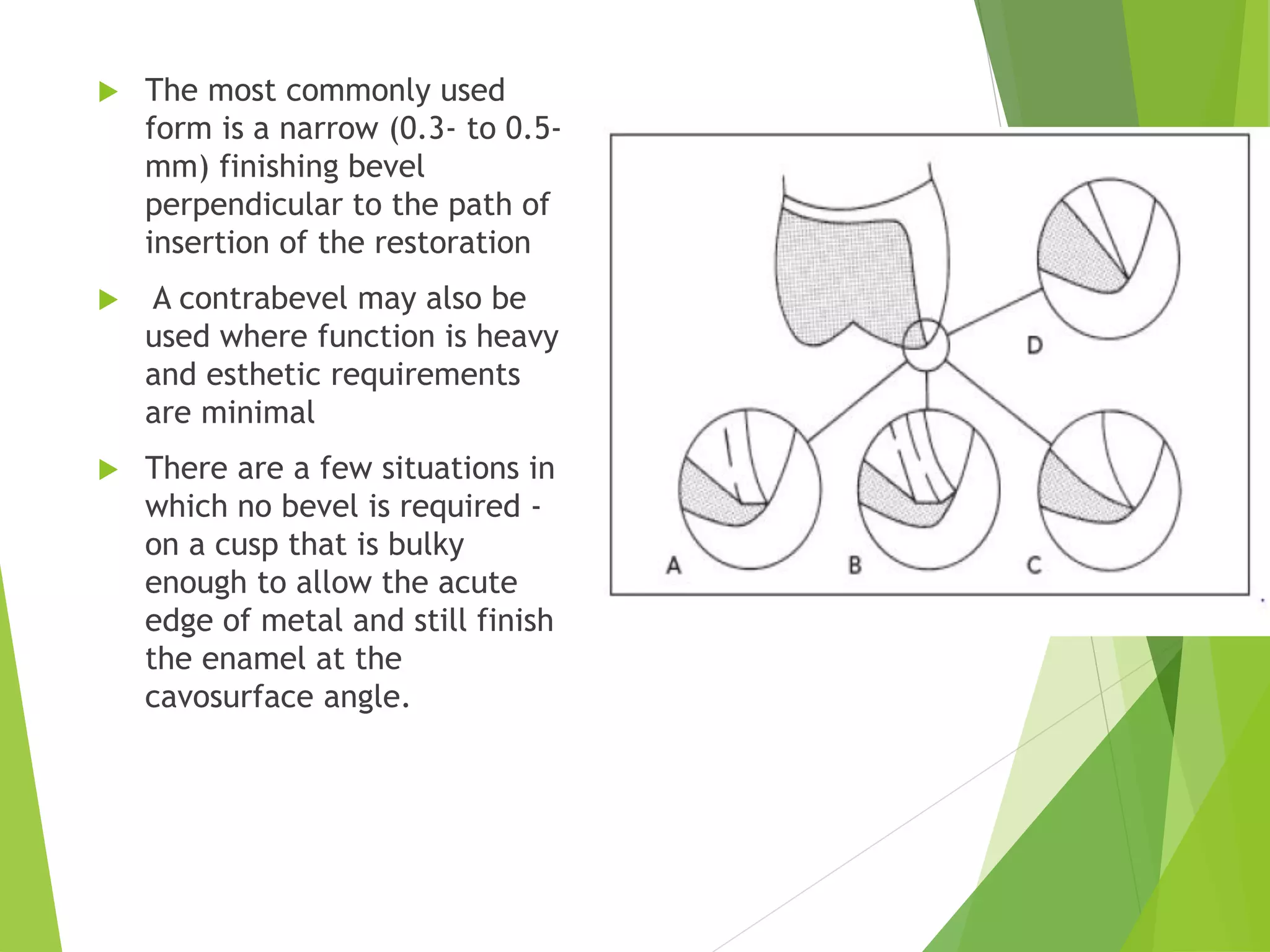 Gingival finish lines in fixed partial denture(FPD) with references | PDF