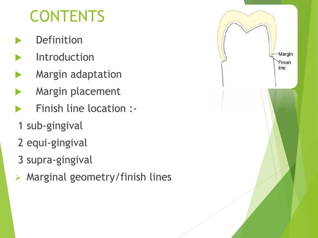 Gingival finish lines in fixed partial denture(FPD) with references | PDF