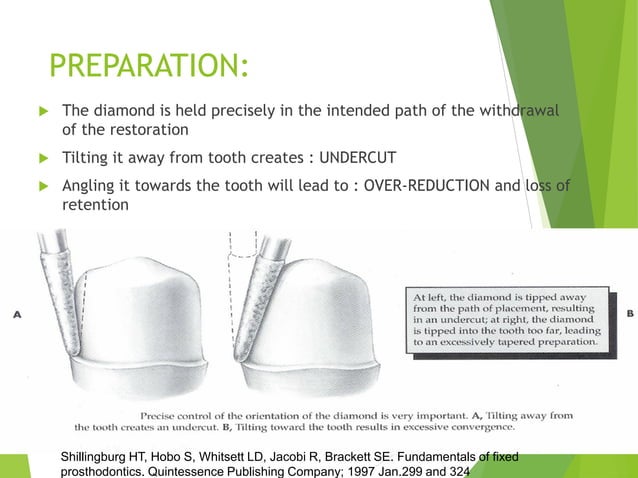 Gingival finish lines in fixed partial denture(FPD) with references | PDF