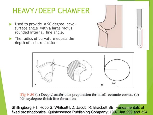 Gingival finish lines in fixed partial denture(FPD) with references | PDF
