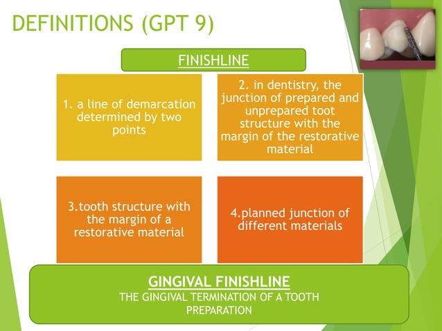 Gingival finish lines in fixed partial denture(FPD) with references | PDF