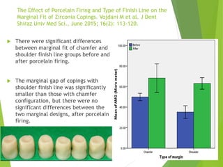 Gingival finish lines in fixed partial denture(FPD) with references | PDF