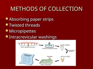 Gingivalctevicular/____gingivalfluid.ppt