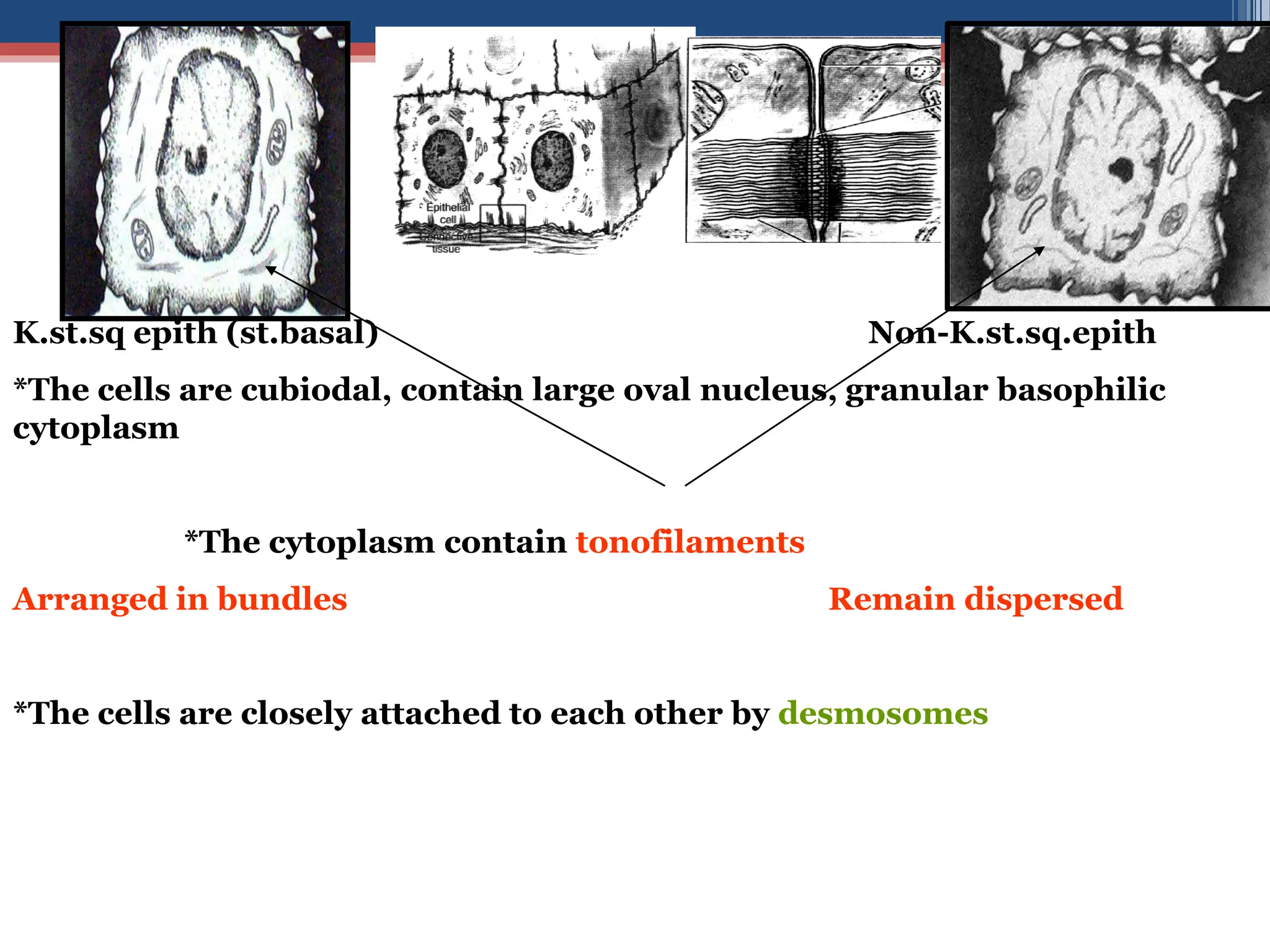 gingival hyperplasia.pdf