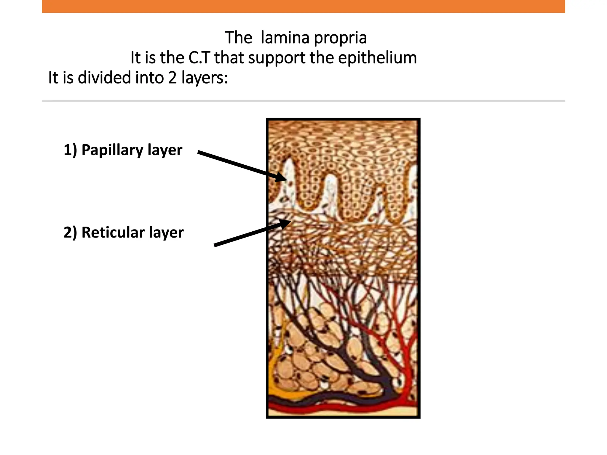 gingival hyperplasia :underlying Pathological mechanisms.pdf
