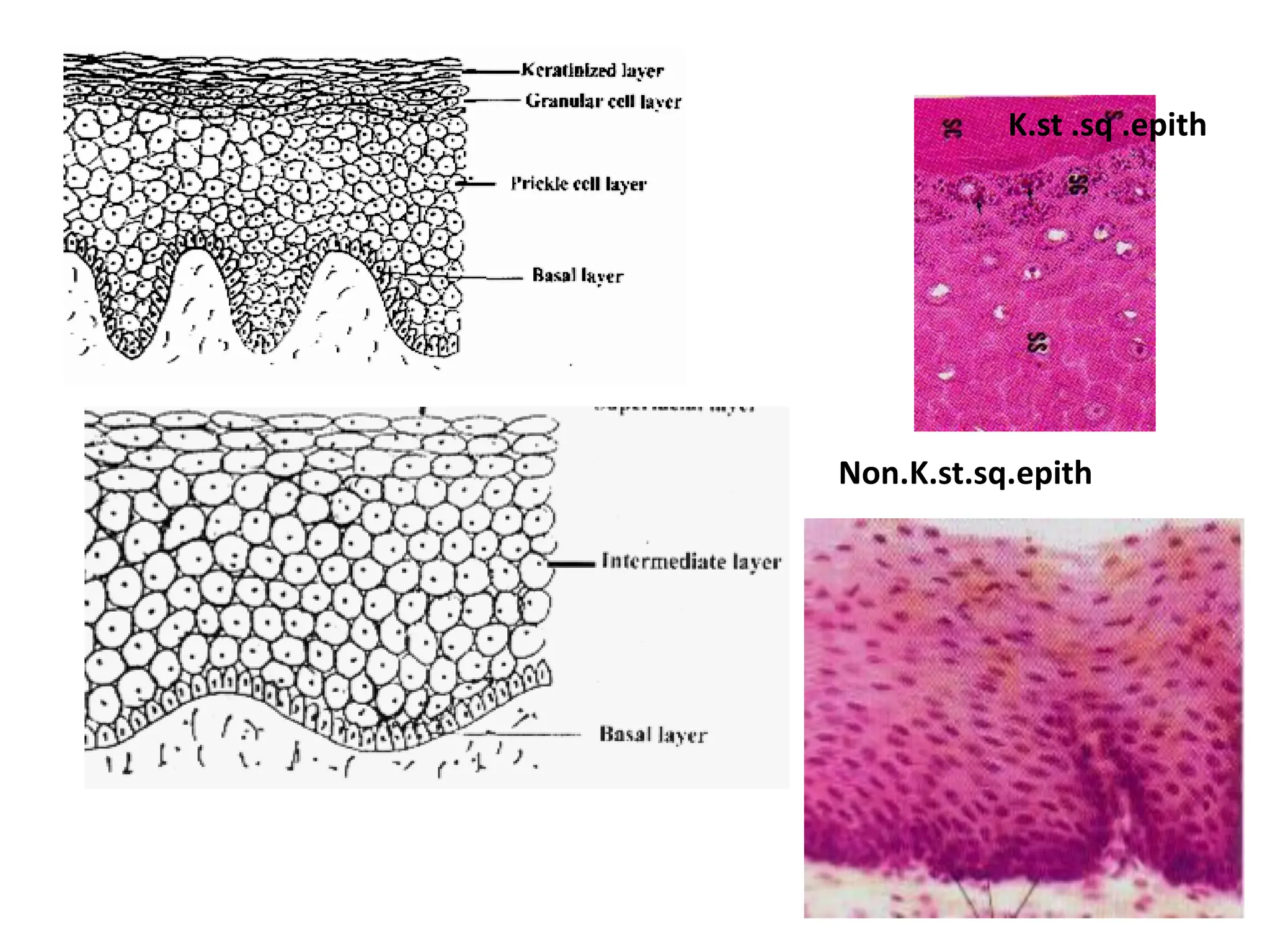 gingival hyperplasia :underlying Pathological mechanisms.pdf