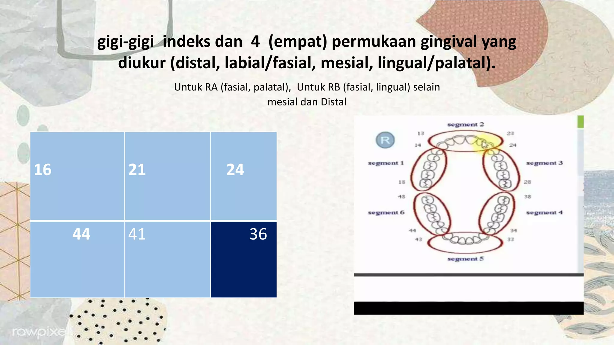 Gingival index.pptx