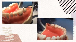 Gingival index.pptx