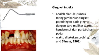 Gingival index.pptx