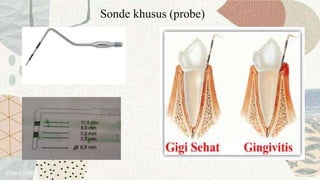 Gingival index.pptx