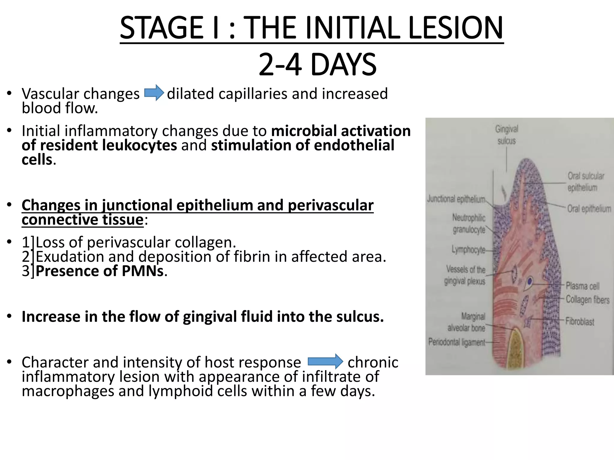 GINGIVAL INFLAMMATION | PPTX