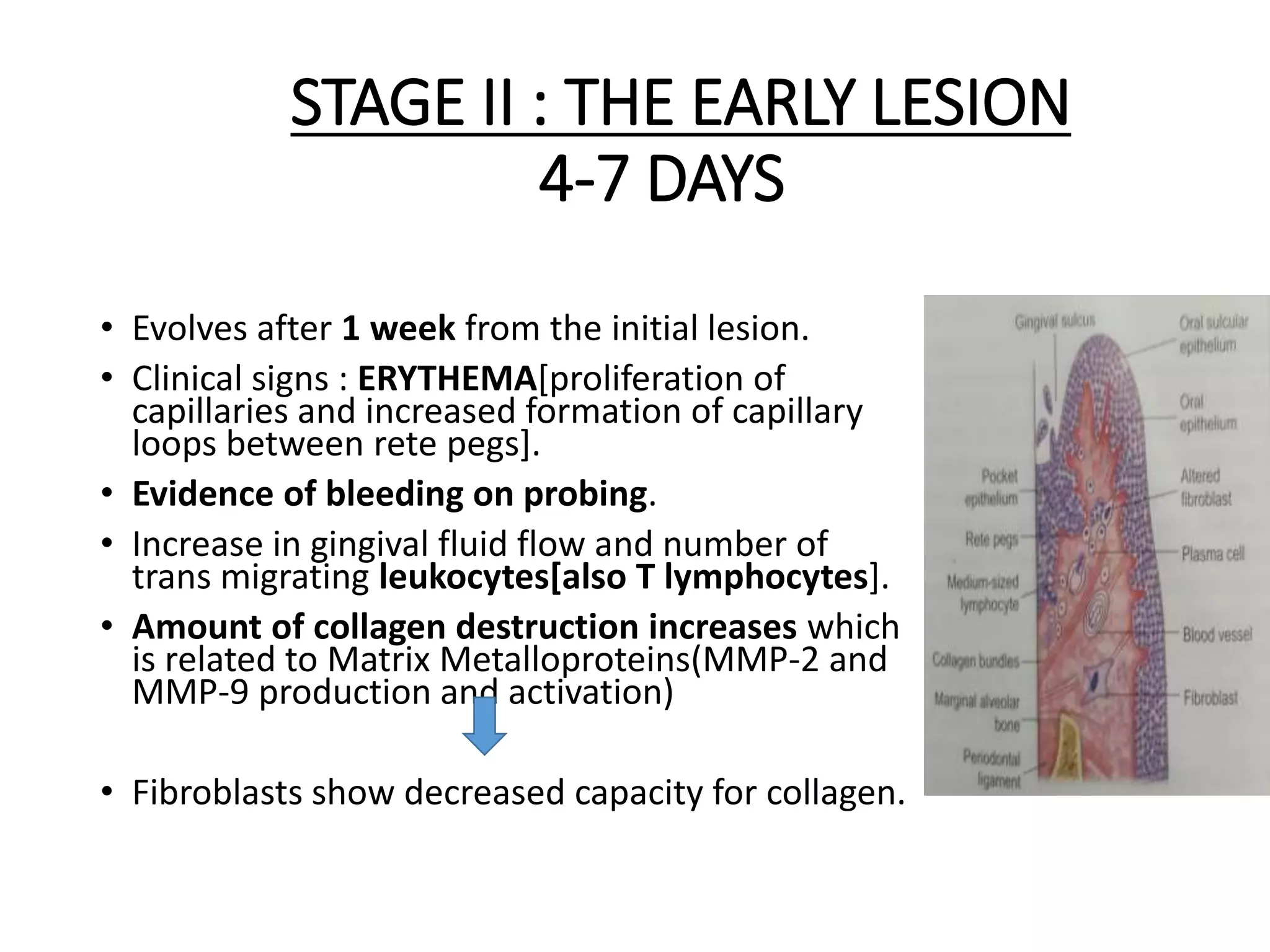GINGIVAL INFLAMMATION | PPTX