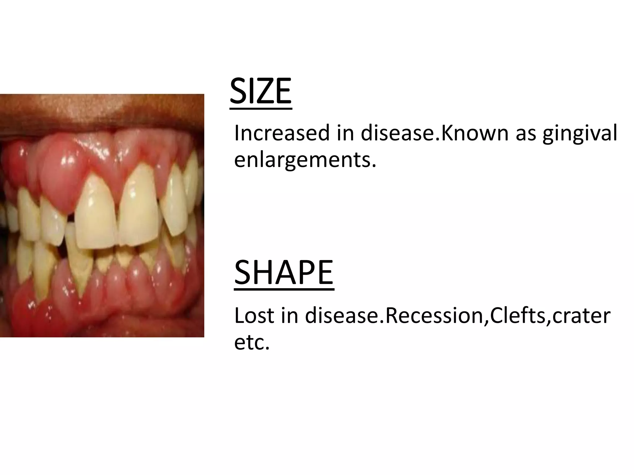GINGIVAL INFLAMMATION | PPTX