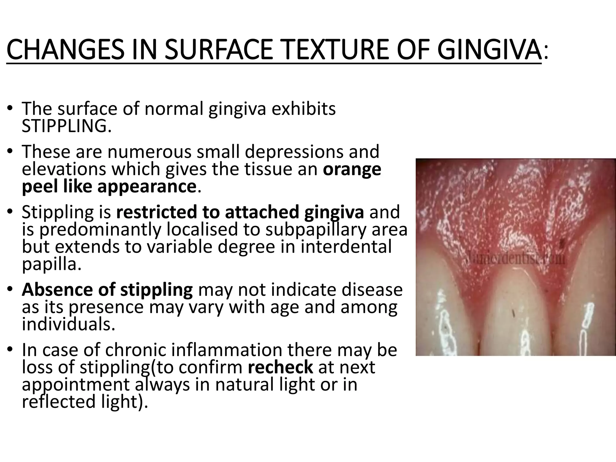 GINGIVAL INFLAMMATION | PPTX