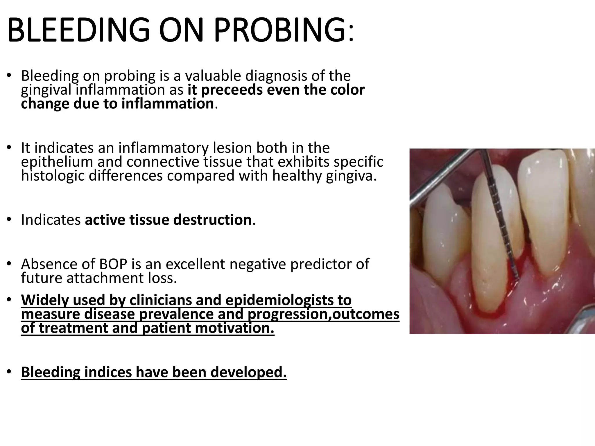 GINGIVAL INFLAMMATION | PPTX