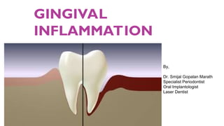 Gingival inflammation - Dr Smijal Gopalan Marath - Specialist ...