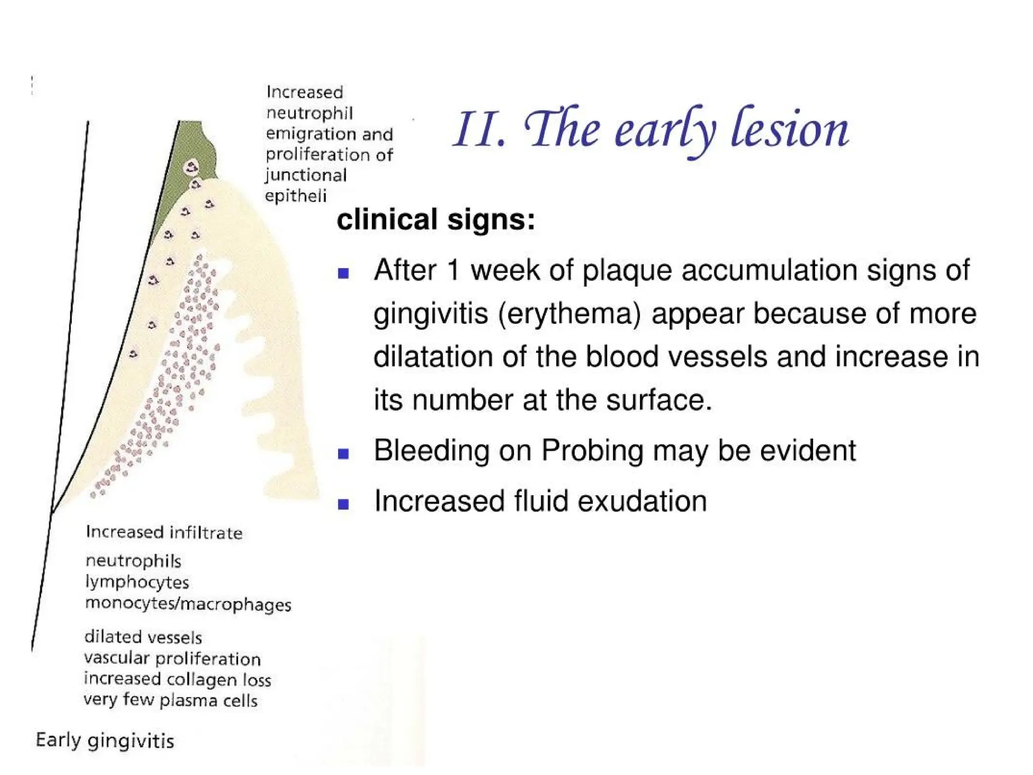 Gingival inflammation and stages of gingivitis.pptx