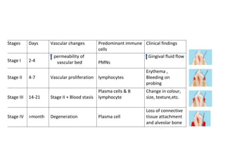 Gingival inflammation and stages of gingivitis.pptx