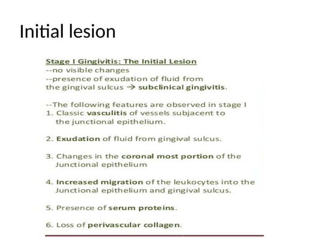 Gingival inflammation and stages of gingivitis.pptx