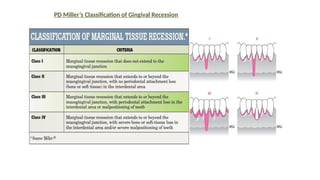 Gingival Inflammation and its clinical features.pptx