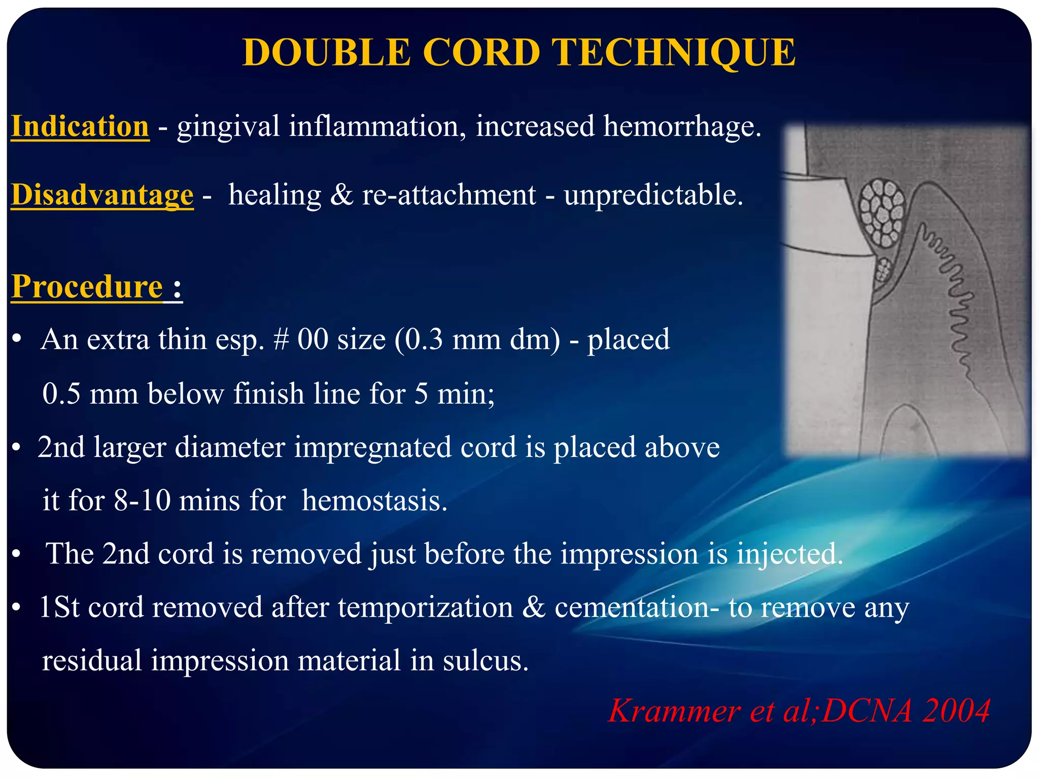 Gingival tissue management | PPTX