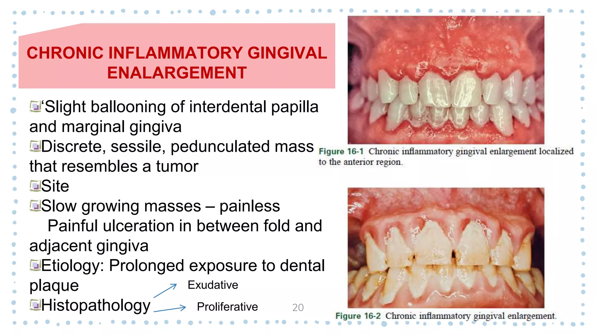 Gingival pathology | PPTX
