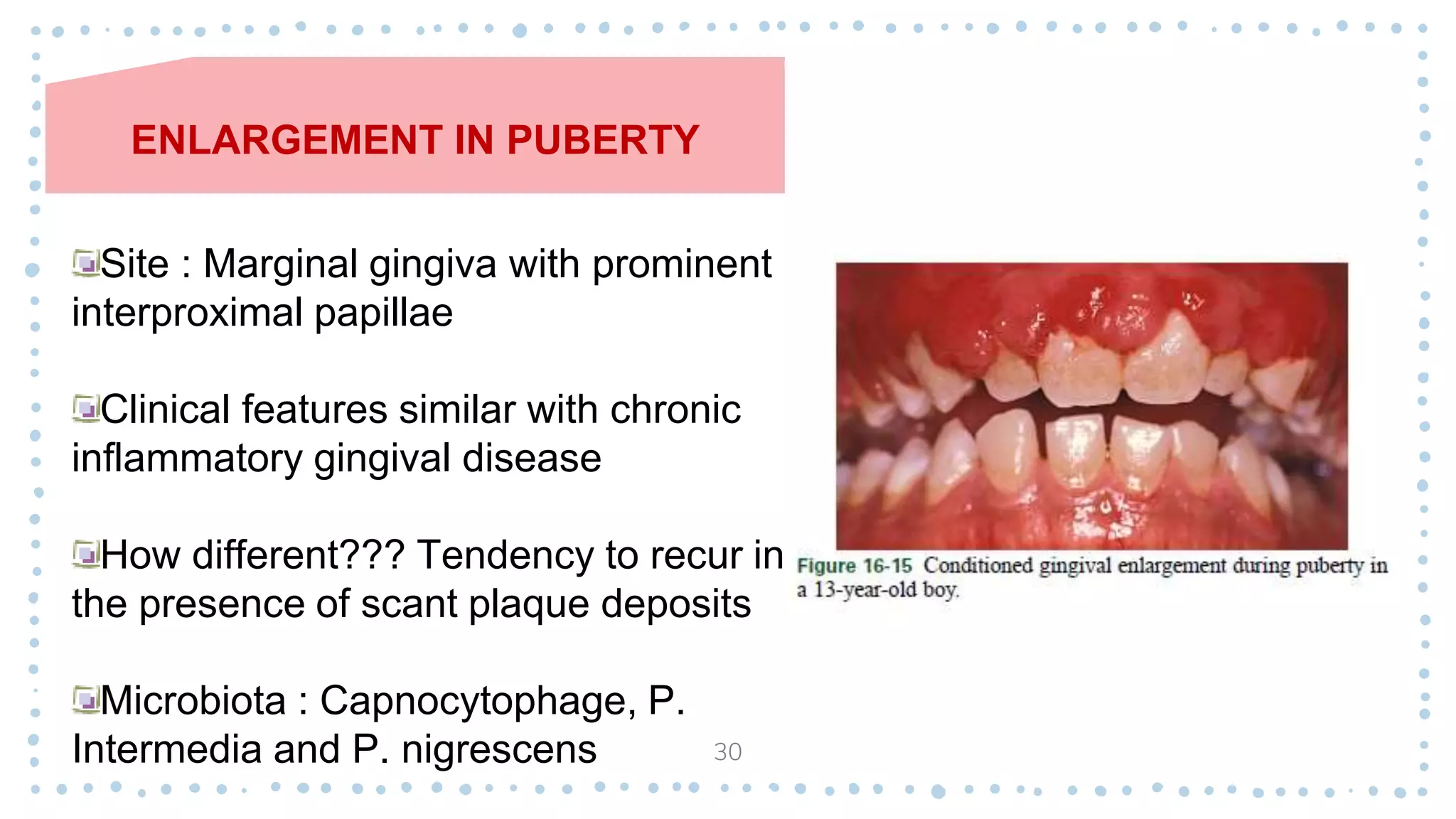 Gingival pathology | PPTX