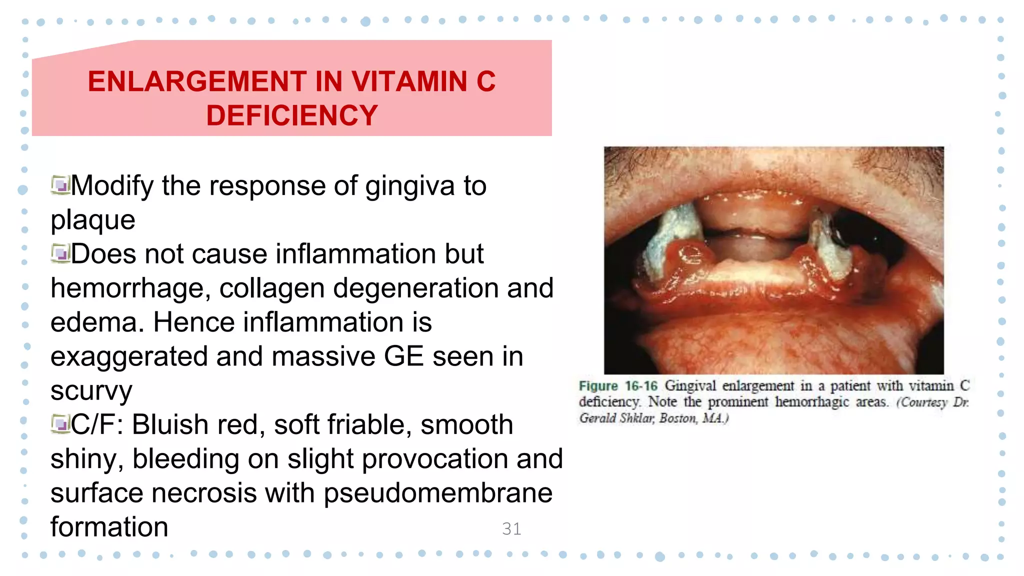 Gingival pathology | PPTX