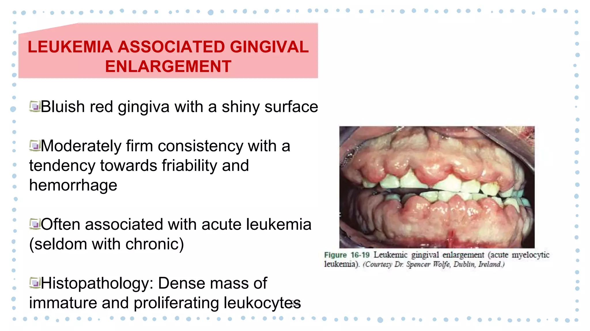 Gingival pathology | PPTX